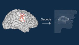 How to decode brain signals into speech ⋆ My Digital